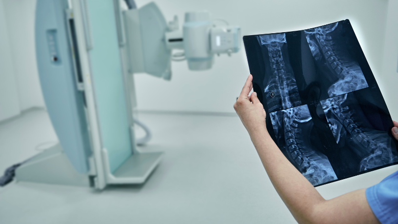 Radiologia intervencionista: Conheça a técnica e suas aplicações no ...